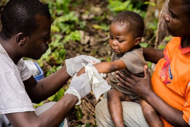 Surges in Monkey Pox in DR Congo Forces Experts into a `Crisis ...
